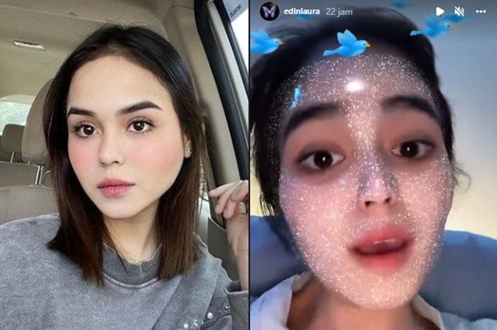 Laura Anna Alami Kecelakaan Parah 2 Tahun Lalu hingga Jadi Lumpuh ...