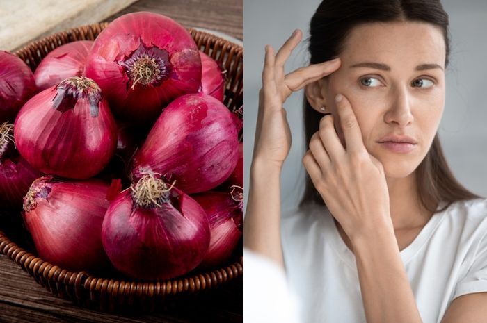 Cara Menghilangkan Flek Hitam dengan Bawang Merah dan Cuka Apel, Wajah ...