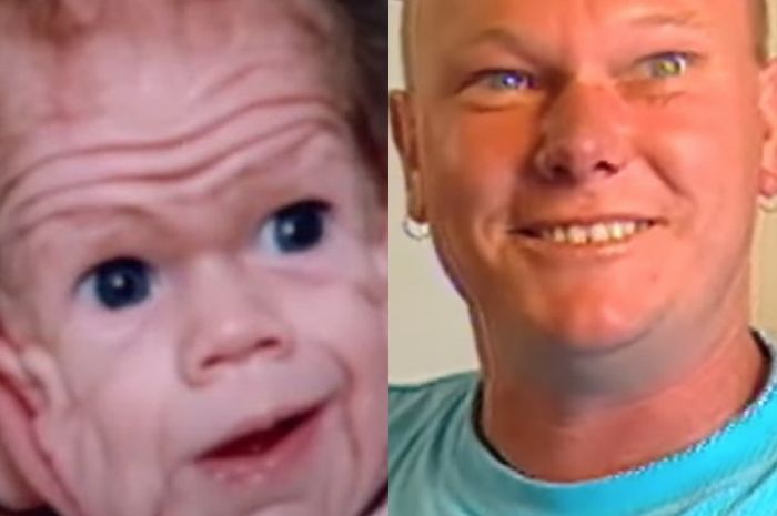 Saat Lahir Sekujur Tubuhnya Sudah Dipenuhi Keriput dengan Wajah ...