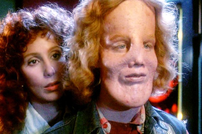 Kisah Hidup Luar Biasa Rocky Dennis, Ketidaknormalan Hidupnya Tak ...