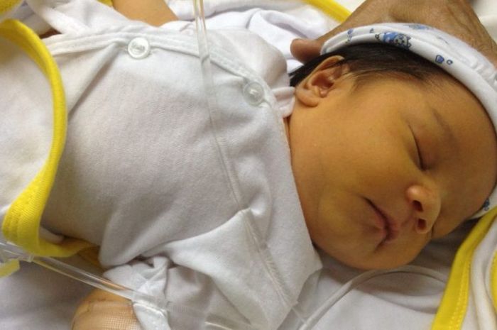 Mengenal Penyakit Kuning Pada Bayi dan Perawatan yang Tepat - Nakita