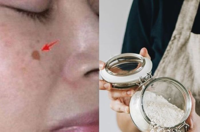 BERITA POPULER : Cara Mengatasi Flek Hitam dengan Bawang Merah Sampai ...