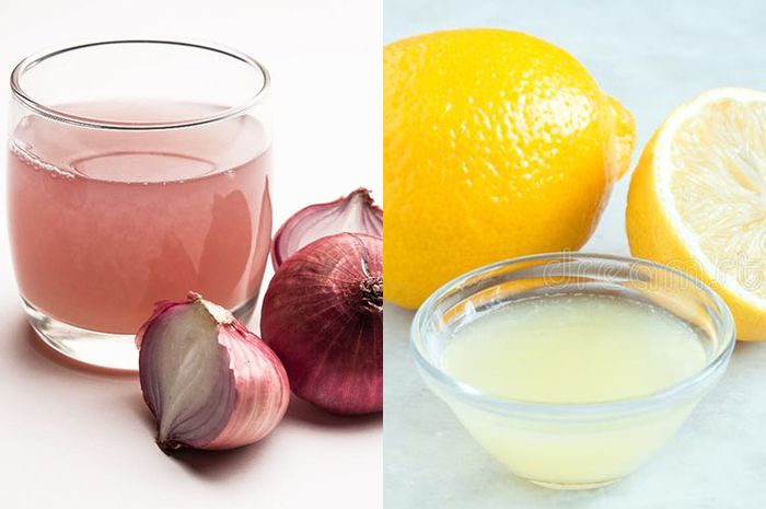 Mudanya Doyan Minum Air Perasan Lemon dan Bawang Merah, Wanita ini Ucap ...