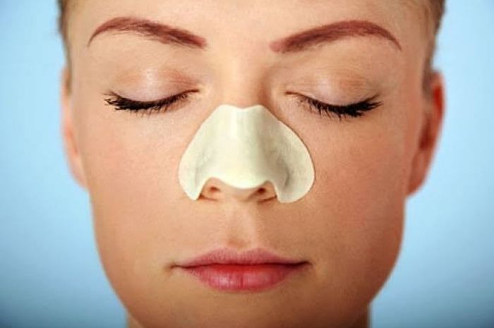 3 Cara Murah dan Gampang untuk Mengatasi Komedo Putih di Wajah - Nova