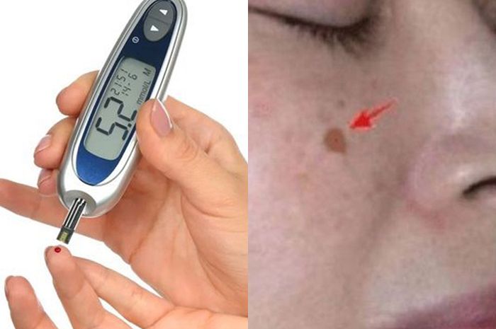 BERITA POPULER : Dari Air Rendaman Sayur Hijau Ini Ampuh Turunkan Gula ...