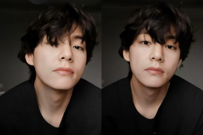 Jadi Standar Ketampanan Para Pasien Operasi Plastik di Korea Selatan, 2 ...