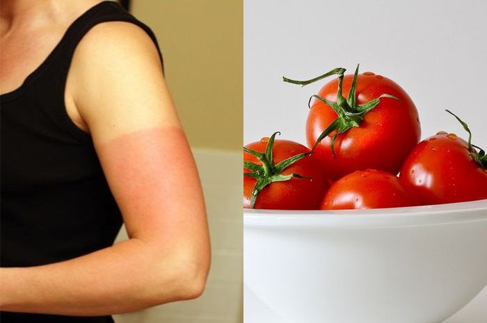 Tiap Hari Naik Motor Bisa Bikin Tangan Belang, Hanya Dalam 15 Menit ...