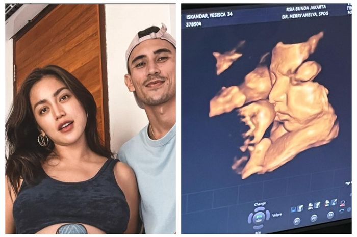 Hamil Besar, Jessica Iskandar Pamer Wajah Janin Dalam Kandungannya ...