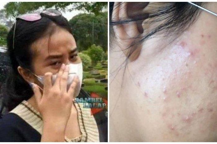 Bak Petir di Siang Bolong, Mayang Akui Tak Pernah Pakai Produk Tan Skin ... Bak Petir di Siang Bolong, Mayang Akui Tak Pernah Pakai Produk Tan Skin ...