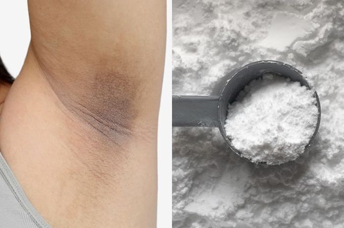 Cuma 20 Menit Bisa Langsung Cerah, Gak Nyangka Ketiak Hitam Dapat ...