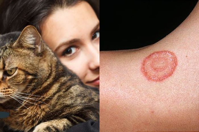 Pecinta Kucing dan Anjing Wajib Tahu, Ringworm Luka Melingkar di Tubuh ...