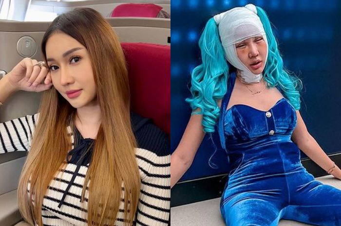 Lucinta Luna PD Pamer Wajah Baru Pasca Operasi Plastik, Intip ...