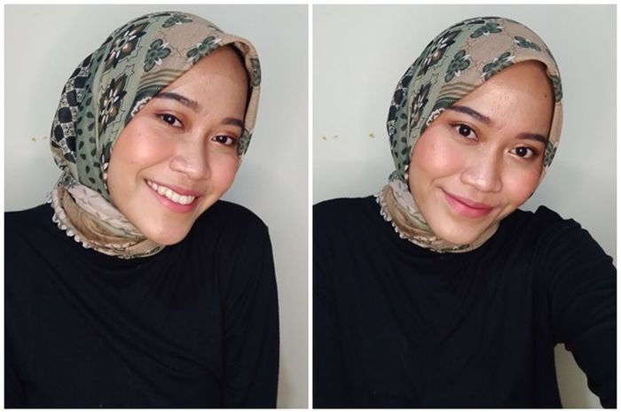 Jurnal Kulit Sensitif Ananda Amelia: Pentingnya Menemukan Basic ...