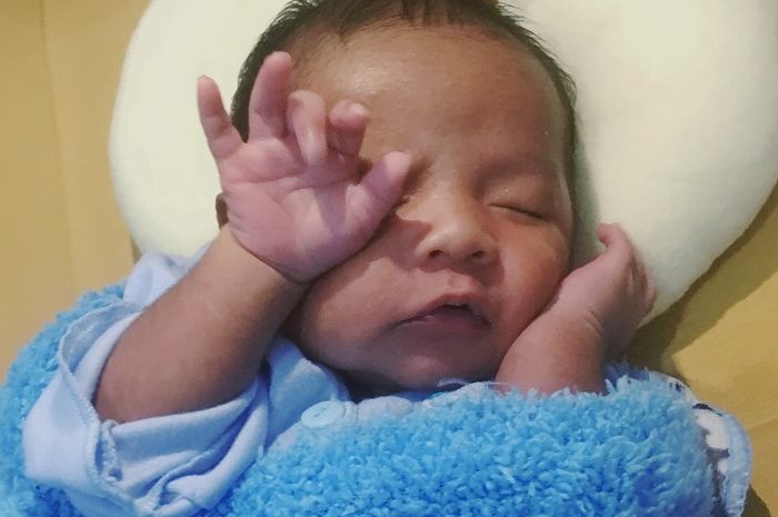 Penasaran Apa Saja Penyebab Korengan pada Bayi dan Cara Mengobatinya ...