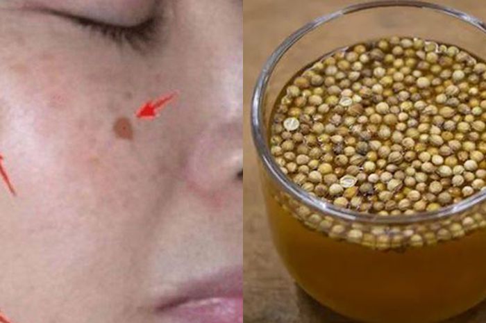 Zaman Dulu Gak Ada Skincare Nenek Moyang Ternyata Hilangkan Flek Hitam
