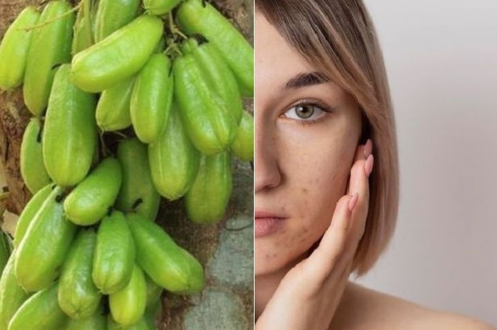 Cantiknya Bak Habis Perawatan, Flek Hitam Di Wajah Bisa Bersih hingga Ke dalam dengan ...