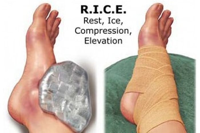 Keseleo Jangan Dipijat, Lakukan Segera Pertolongan Pertama Ini! - Grid ...