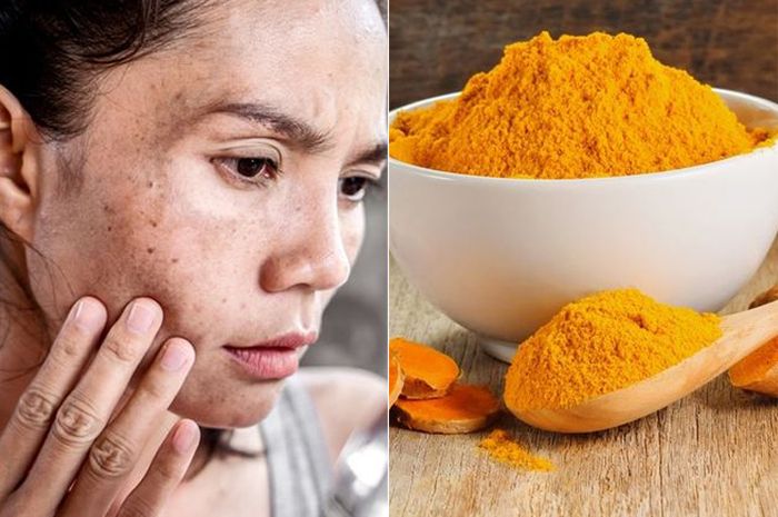 Cantiknya Bak Habis Perawatan, Flek Hitam Di Wajah Bisa Bersih hingga ...