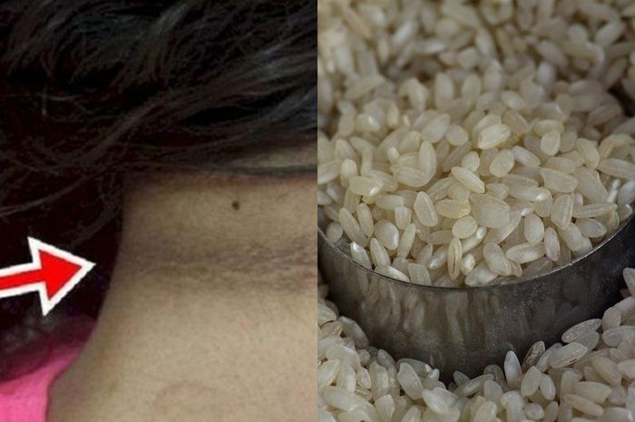 Tutupi Malu Gegara Daki Hitam di Leher, Coba Hilangkan Pakai Beras ...