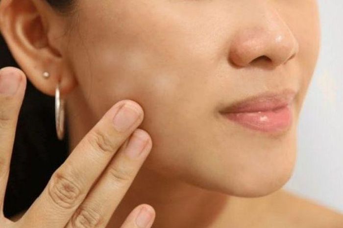 Pilihan Salep Panu yang Tersedia di Apotik Lengkap dengan Harga Terbaru ...