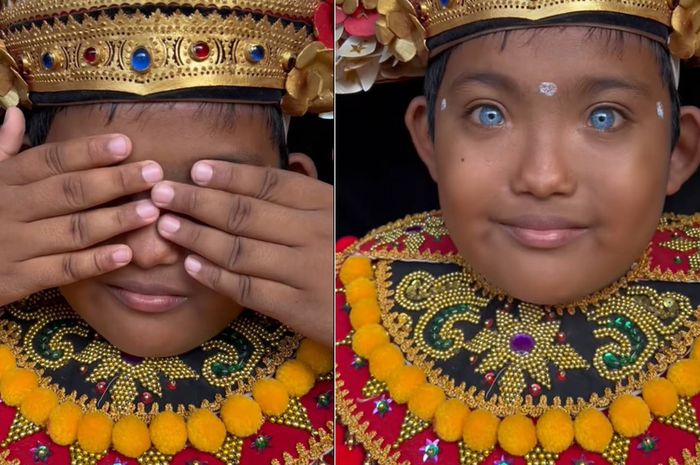 Dulu Dibully, Bocah Mata Biru Asal Buleleng Bali Ini Malah Dikagumi ...