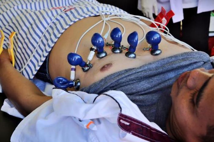 Biaya Pemeriksaan Jantung Murah, Hanya 30 Ribu Rupiah! Ini Caranya - Grid Health