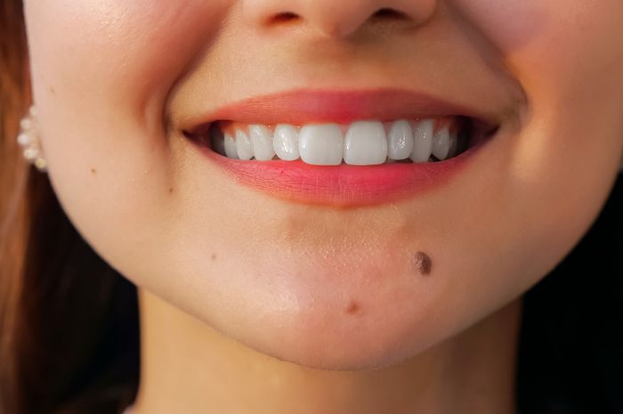 Selain Buat Percaya Diri, Ini Alasan Kesehatan Kenapa Gigi Harus Rapi ...
