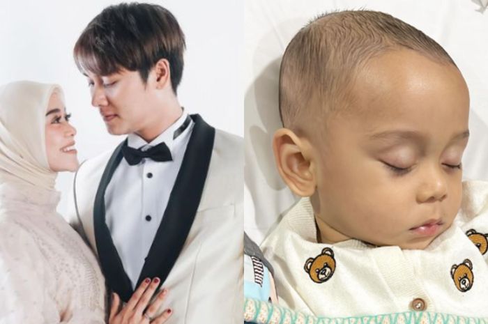 Anak Rizky Billar dan Lesty Kejora Idap Hernia, Kapan Sebaiknya Harus ...