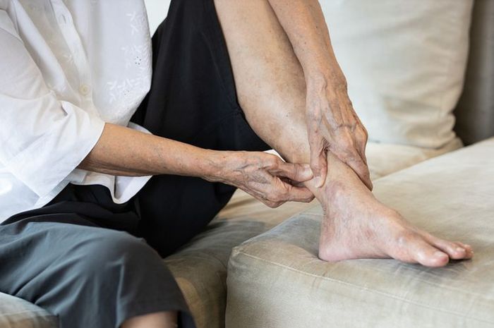 Jangan Diabaikan, Ini Tanda-tanda Kolesterol Tinggi yang Terasa di Kaki ... Jangan Diabaikan, Ini Tanda-tanda Kolesterol Tinggi yang Terasa di Kaki ...