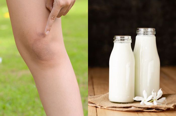 Bukan Digosok Lulur, Lutut Hitam jadi Cerah Permanen Hanya dengan Susu ...
