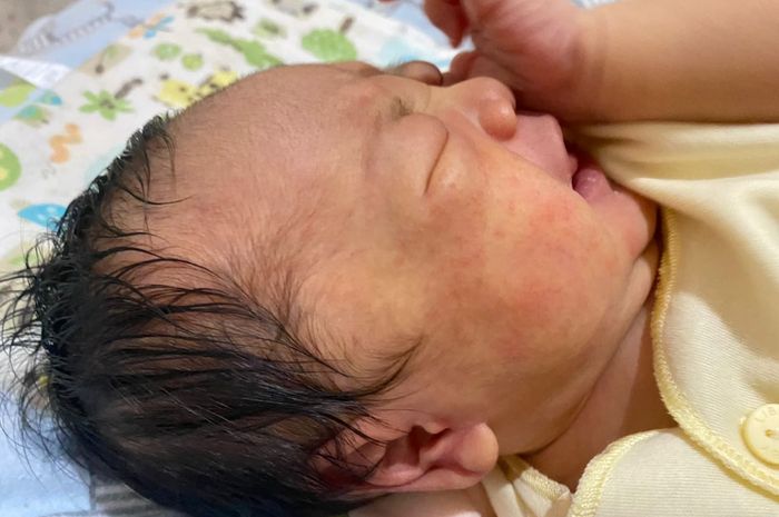 Penanganan yang Tepat dan Pemberian Obat Demam Bayi Baru Lahir - Semua Halaman - Nakita