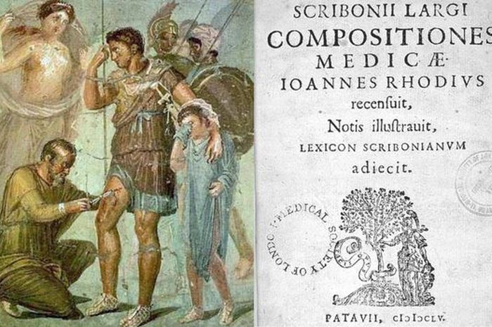 Scribonius Largus, Tabib Romawi yang Gunakan Listrik untuk Pengobatan ...