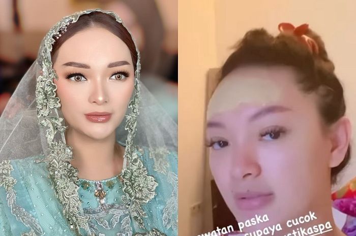 Pantas Zaskia Gotik Mau Pakai Pilis Pasca Lahiran Normal, Ternyata Ini ...