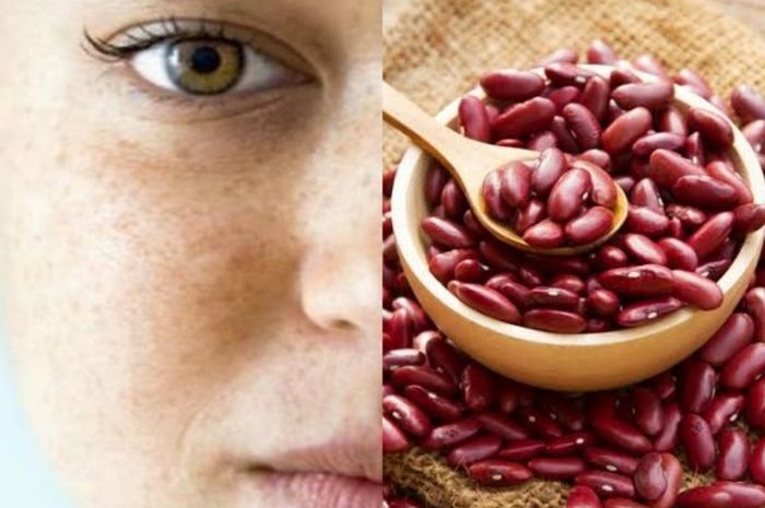 Gak Perlu Keluar Modal Buat Melenyapkan Flek Hitam, Coba Ambil Kacang ...