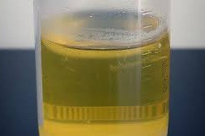 Kenapa Air Kencing 'Normal' Berwarna Kuning? Ini Penyebabnya - National ...