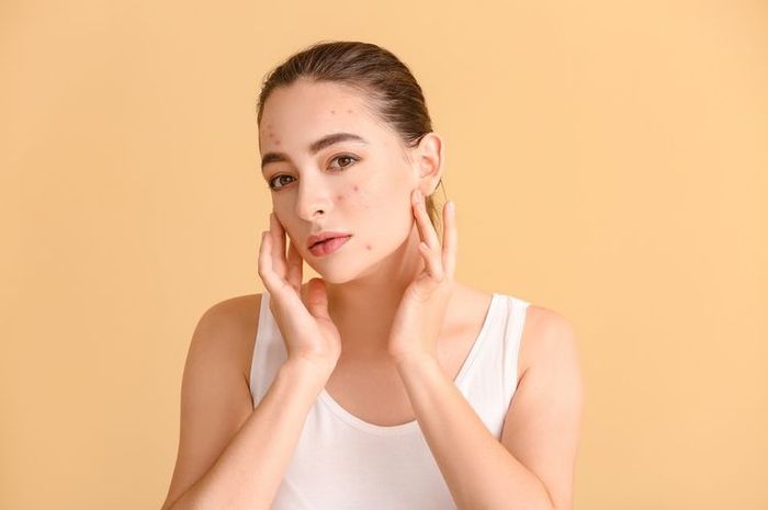 Jadi Penyebab Susah Glowing, Ini Ciri-ciri Skin Barrier Rusak yang ...