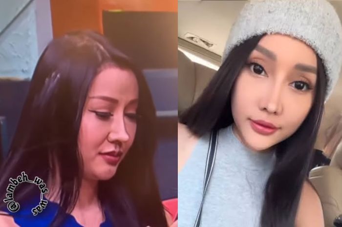 Lucinta Luna Ngaku Belum Puas Operasi Plastik Meski Wajah Telah Kena ...