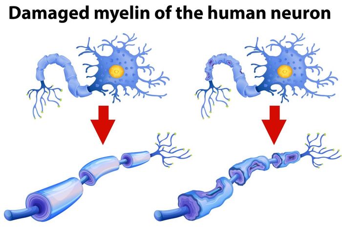 Sel Saraf Manusia: Bagian, Fungsi, dan Proses Jalannya Rangsang dalam ...