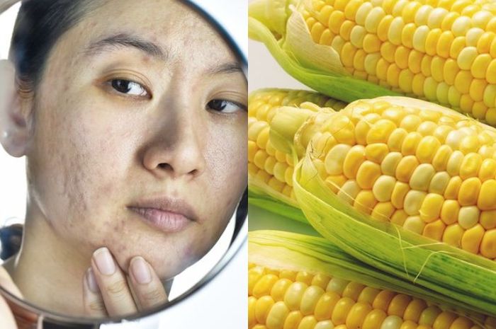 Cukup Gunakan Jagung, Ini Cara Menghilangkan Bopeng dan Bekas Jerawat ...