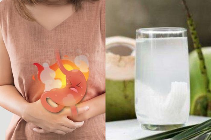5 Cara Mengatasi Asam Lambung yang Mendadak Kambuh, Salah Satunya Minum Air Kelapa - Sajian Sedap