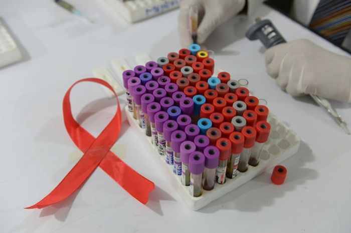 Kabar Gembira dari Uji Klinis Pertama Vaksin HIV pada Manusia ...