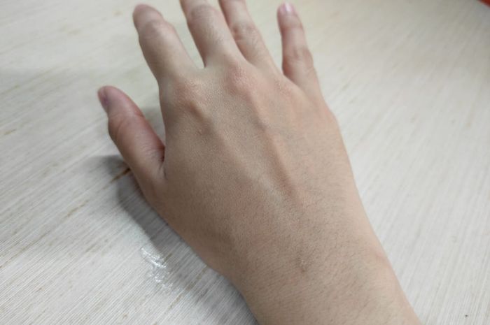 Ketahui Penyebab Telapak Tangan Gatal, Inilah Perawatannya yang Bisa ... Ketahui Penyebab Telapak Tangan Gatal, Inilah Perawatannya yang Bisa ...