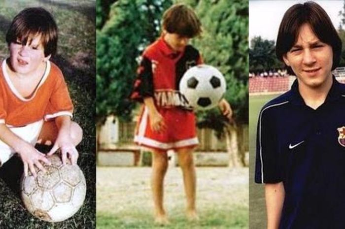 Dwarfisme Hipofisis, Penyakit Langka Yang Pernah Diderita Sosok Leo ...