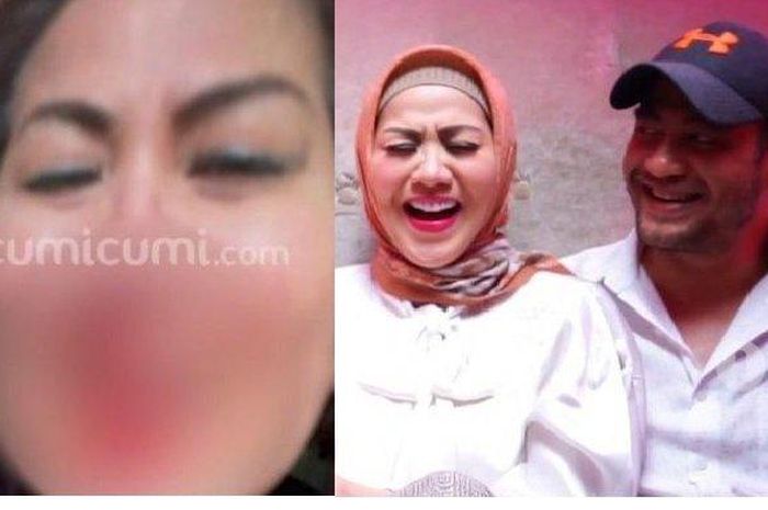 Tega Buat Hidung Venna Melinda Berdarah-darah, Ferry Irawan yang Diperiksa Polisi Atas Dugaan ...