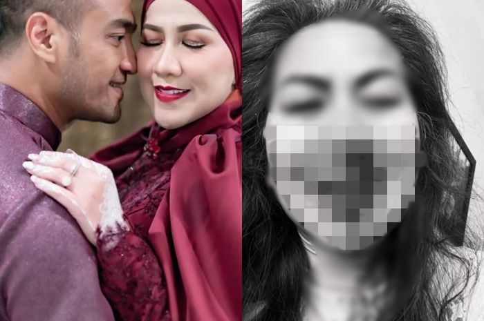 Venna Melinda Ungkap 2 Pemicu Ferry Irawan Lakukan KDRT, Salah Satunya Soal Ranjang - Nova