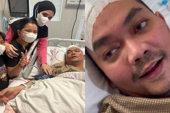 Aldila Jelita Mohon Doa, Indra Bekti Jalani Pemasangan Alat VP Shunt di Kepala, Ini ...