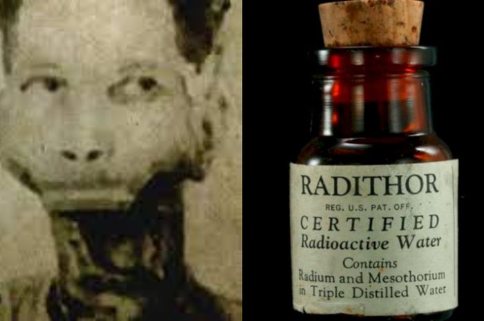 Mengenal Radhitor 'Obat Ajaib' yang Menghancurkan Rahang Eben Byers ...