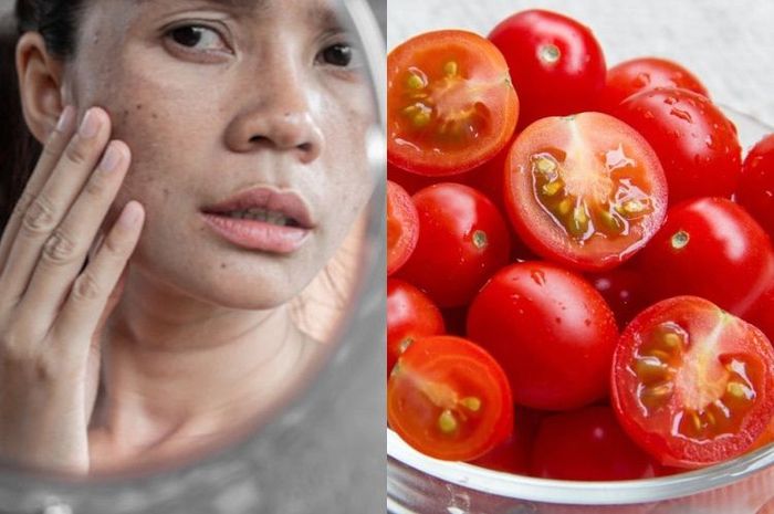 Cara Hilangkan Noda Hitam di Wajah dengan Tomat, Cukup Dipakai 15 Menit ...