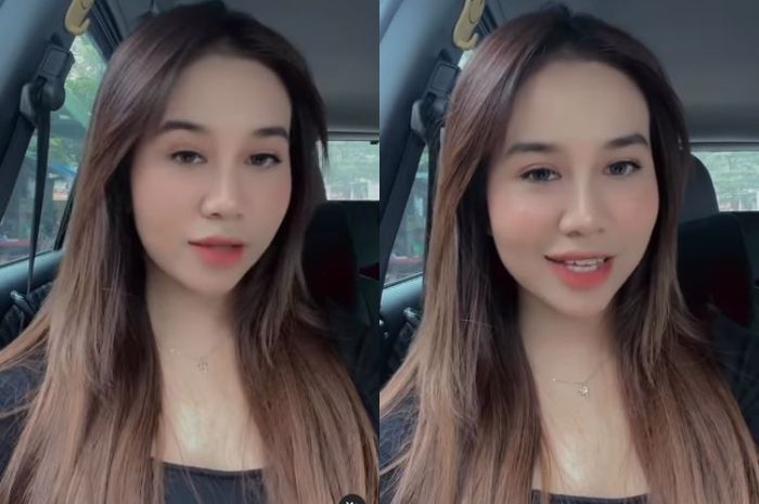 Merasa Tak Puas, Mayang Akui Ingin Operasi Hidung Lagi Agar Lebih Lancip