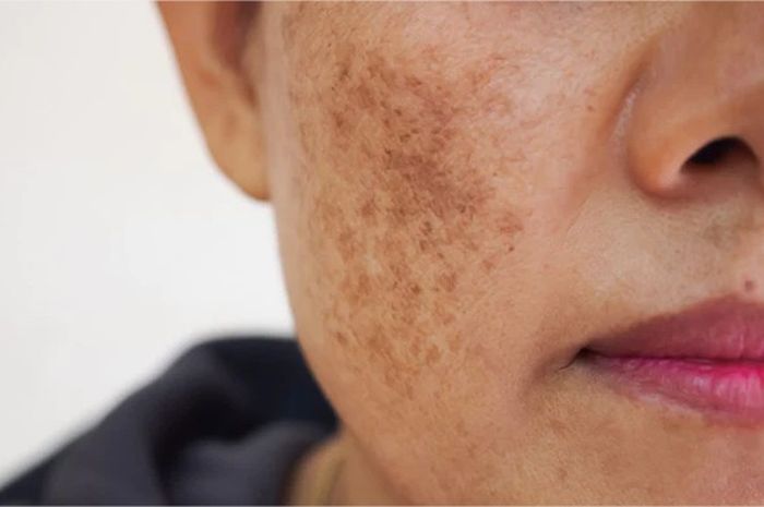 Skincare Mahal pun Gak Mempan Kalau Masih Lakukan Kebiasaan Sepele yang ...